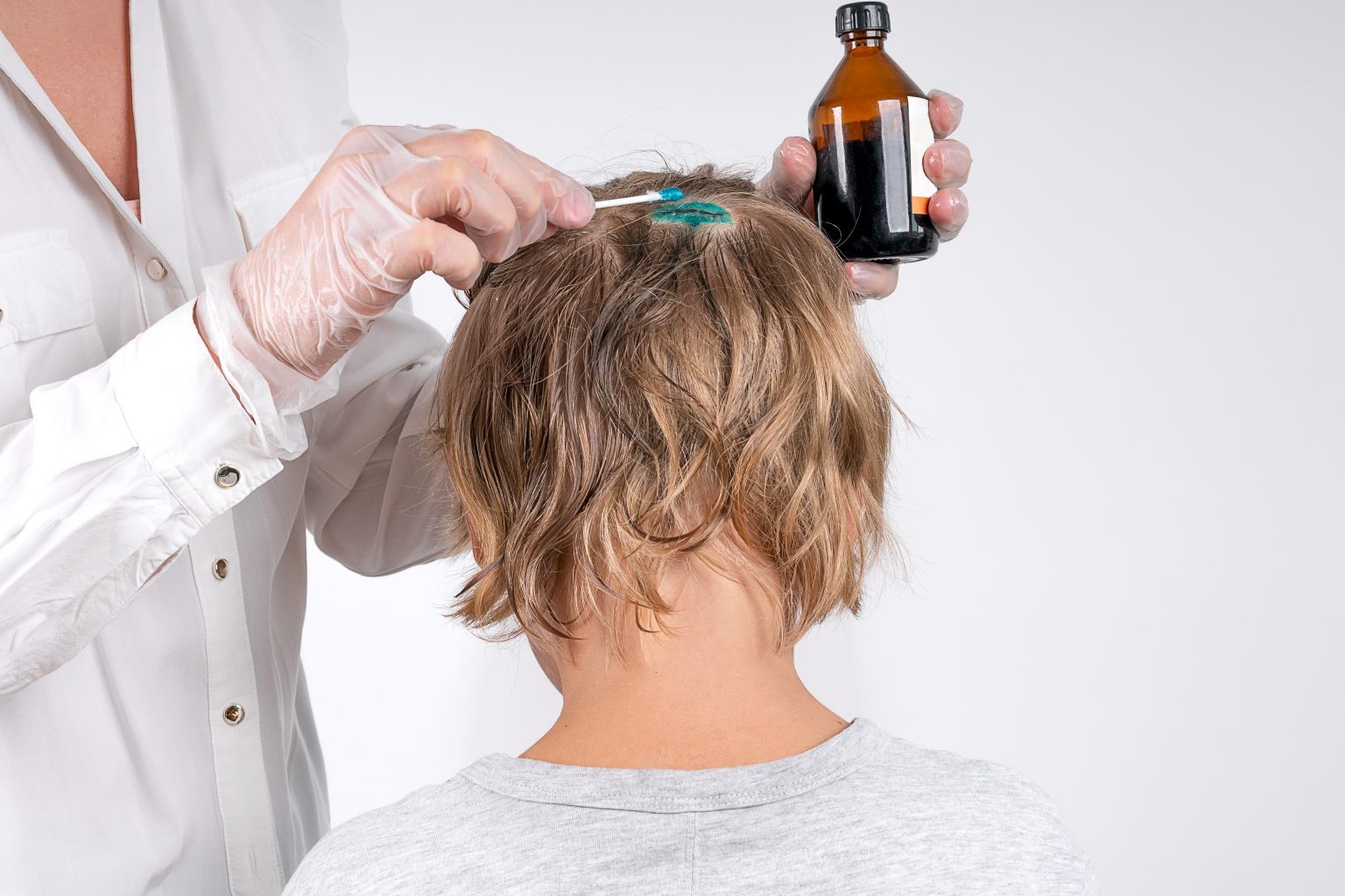 Headache Back Of The Head - 4 Proven Causes Of This Pain